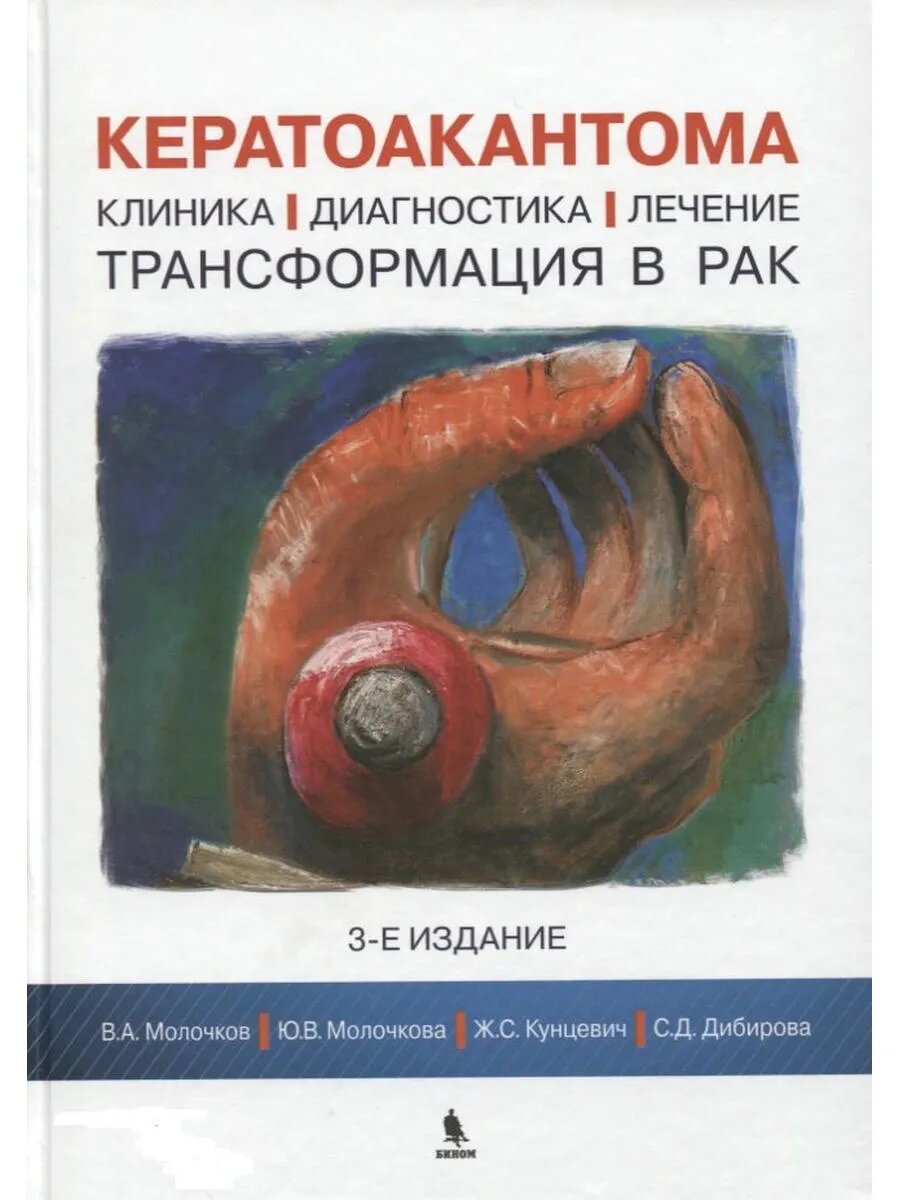 Кератоакантома. Клиника, диагностика, лечение, трансформация