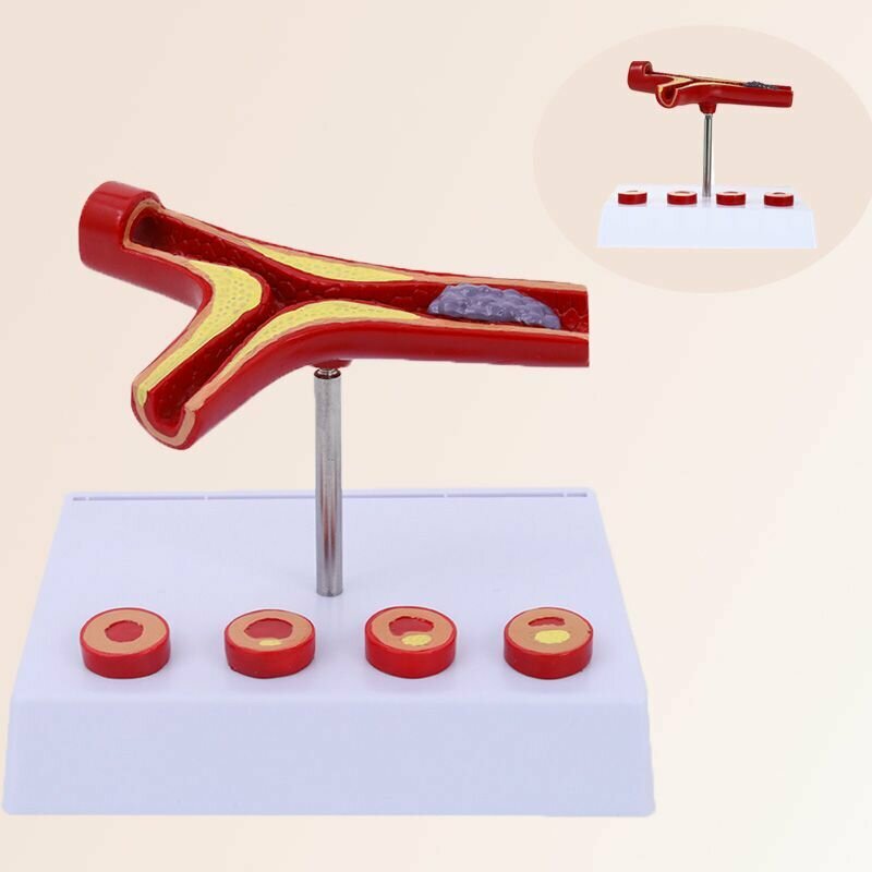 Анатомическая модель