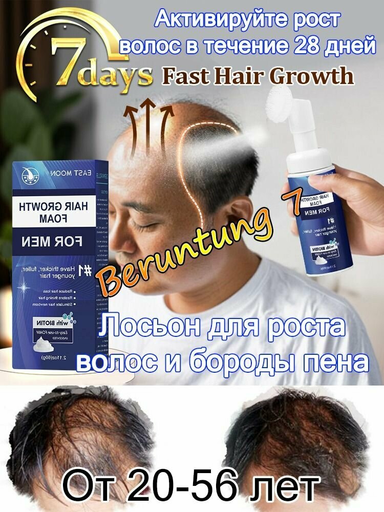 Лосьон для роста волос и бороды пена для наружного применения, средство против выпадения и облысения, сыворотка-активатор, бустер роста усов для мужчин 60 мл содержит массажёр и биотин
