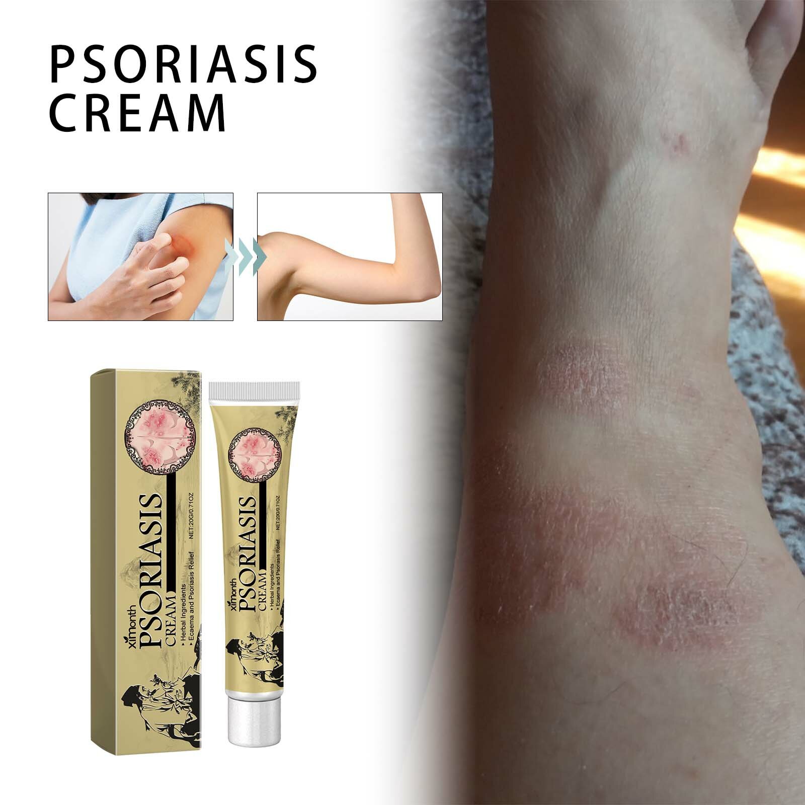 Крем против зуда кожи снимает покраснение и зуд рук и ног, увлажняет и восстанавливает кожу. Крем против зуда