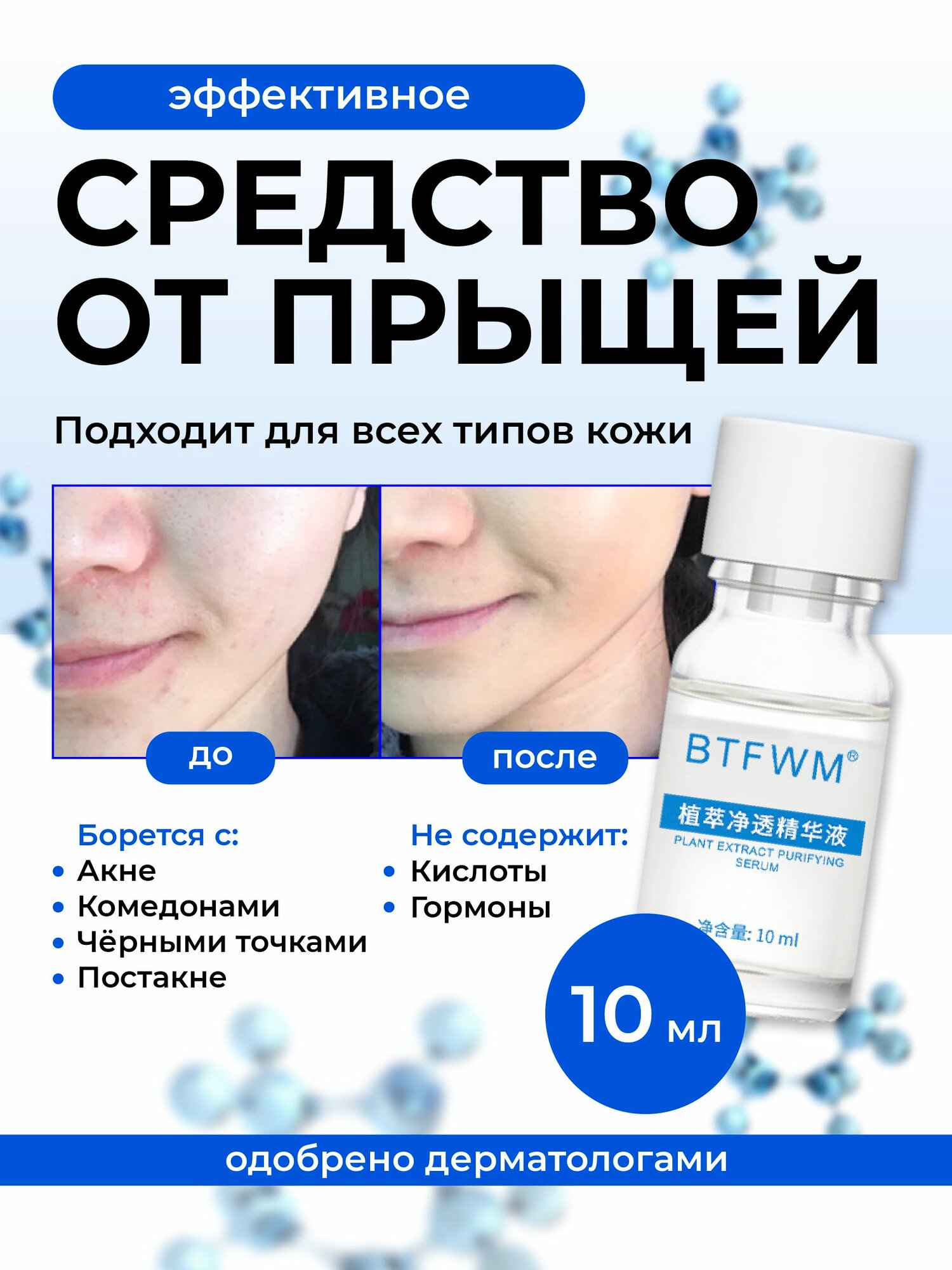 Средство от прыщей на лице, крем / сыворотка от прыщей, для сужения пор, "Plant", 10 мл