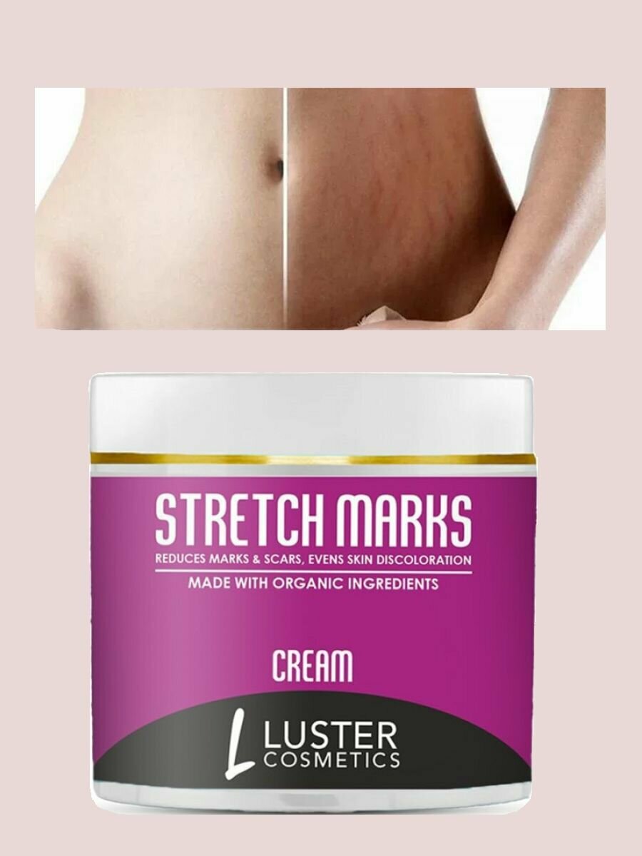 LUSTER Stretch Marks Cream Крем для тела против растяжек и для упругости кожи. 100мл