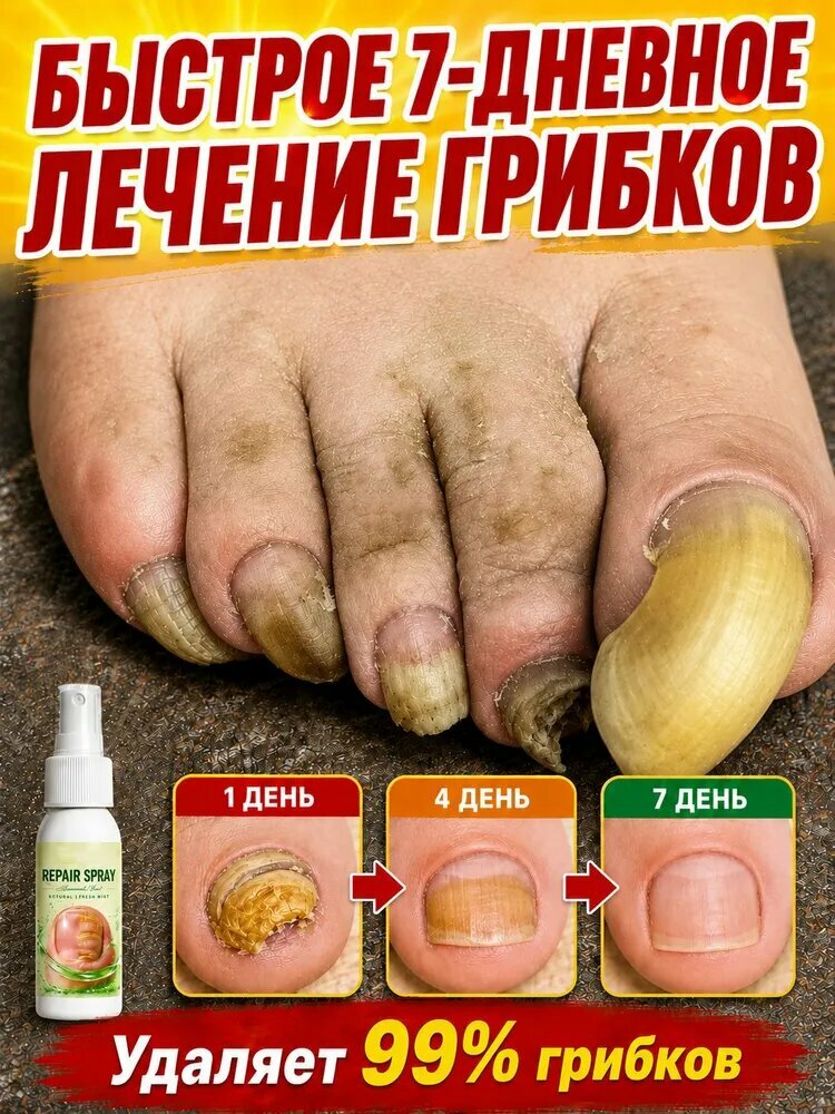 Противогрибковый спрей для ногтей на руках и ногах, 30 мл лечение онихолизиса, рост и укрепление ногтей, без запаха