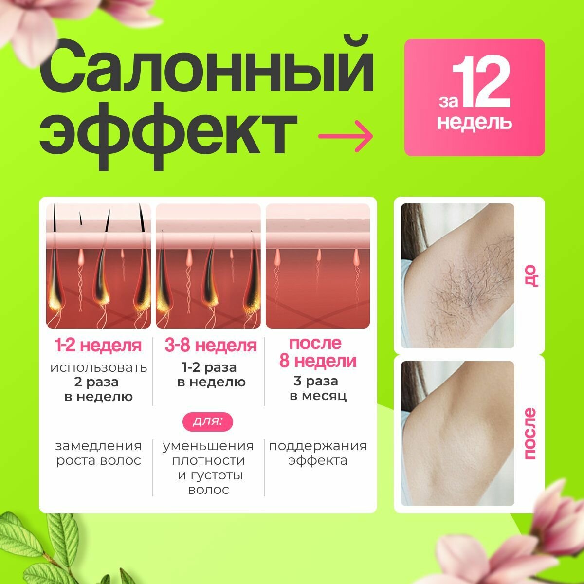Фотоэпилятор
