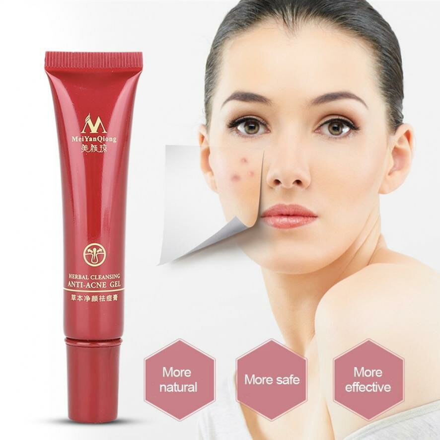 15 г натуральный гель для удаления шрамов, угрей, прыщей, пятен, крем-мазь