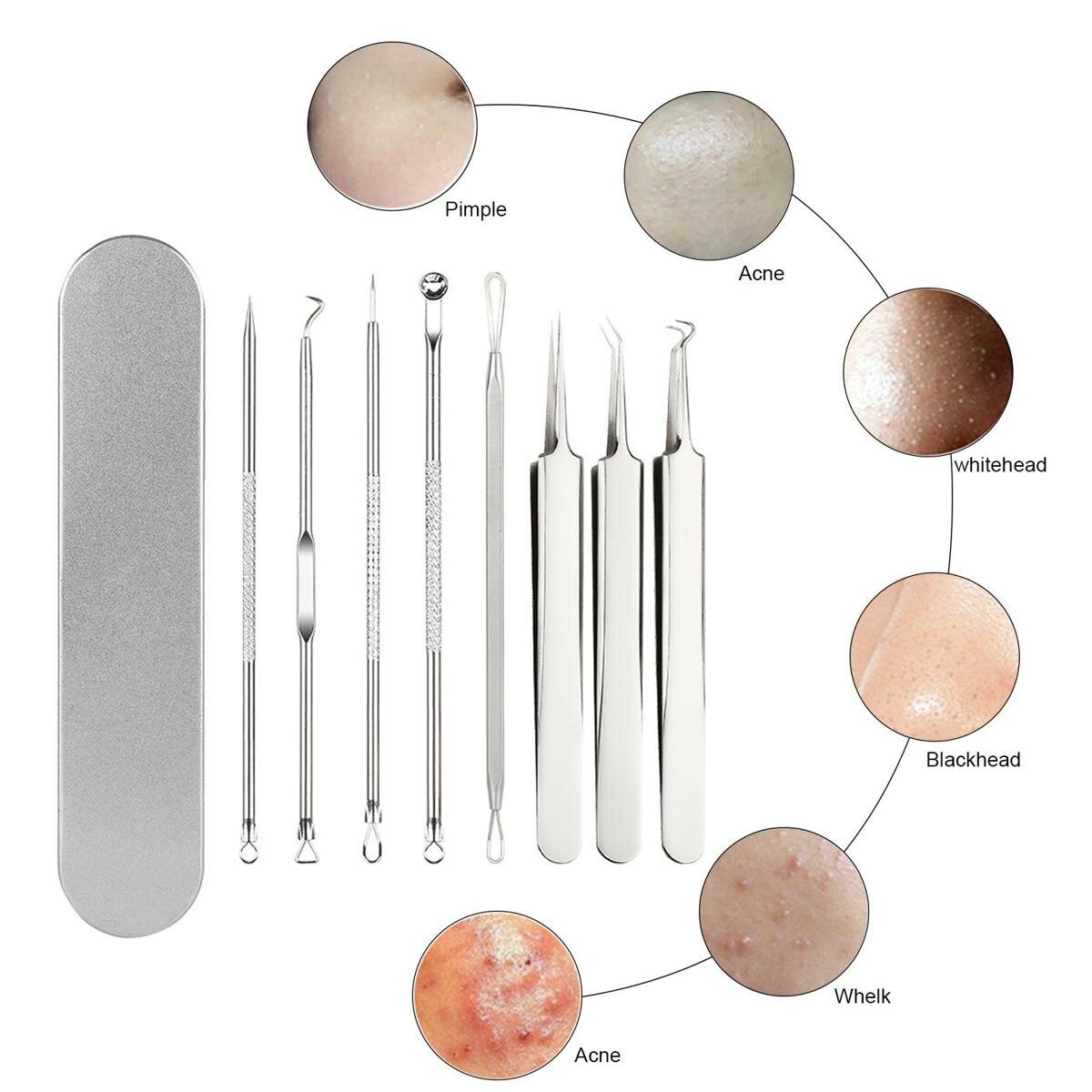Набор из 8 игл для удаления угрей и черных точек, очищающее средство для черных точек, набор инструментов для глубокого очищения кожи лица