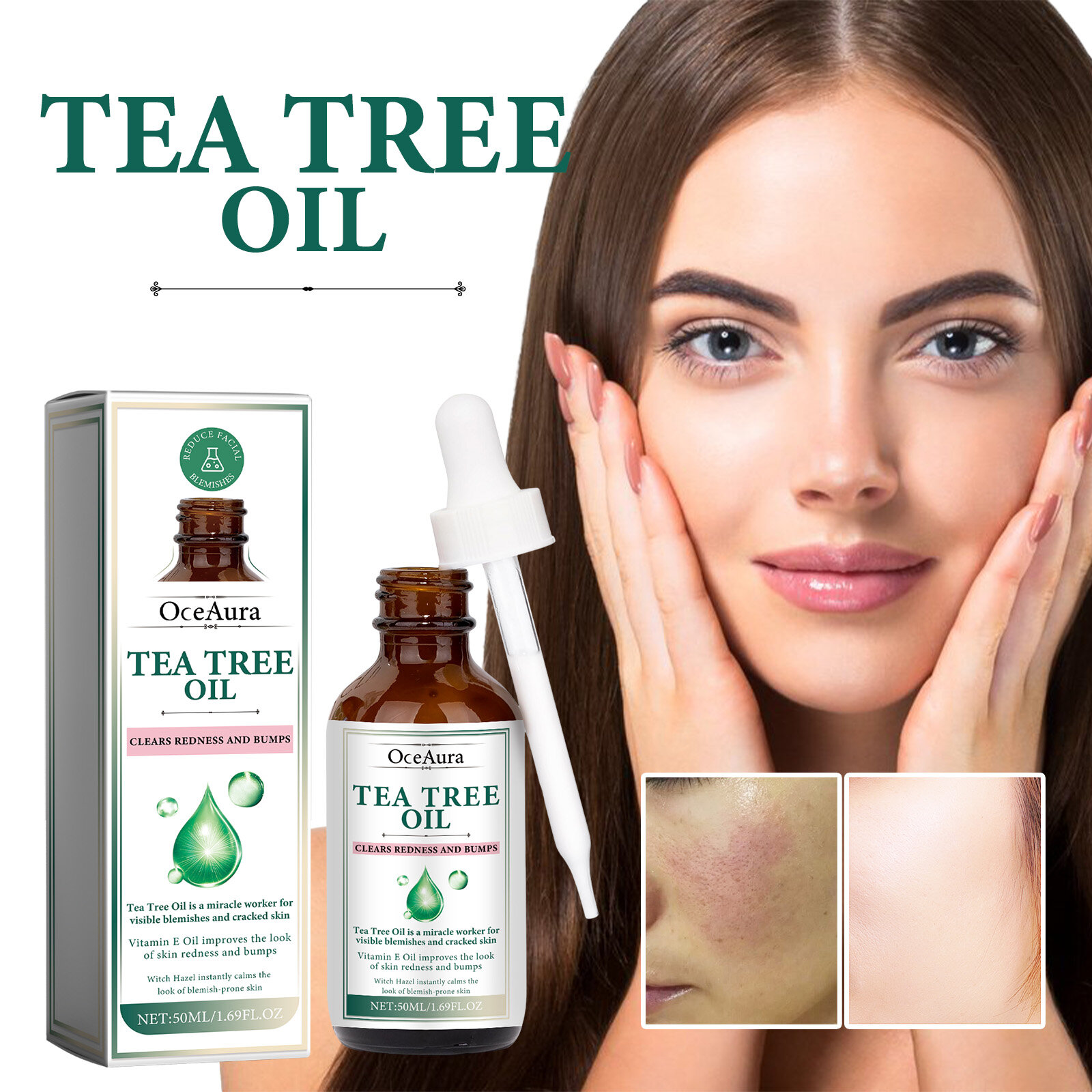 Эссенция для лица с маслом чайного дерева увлажняет кожу лица, уменьшает количество закрытых комедонов, увлажняет и ухаживает за лицом