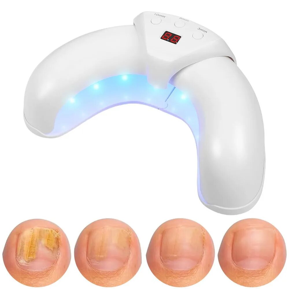 Лазерный аппарат для лечения грибка ногтей, 22 светодиода, синий свет, ЖК-дисплей