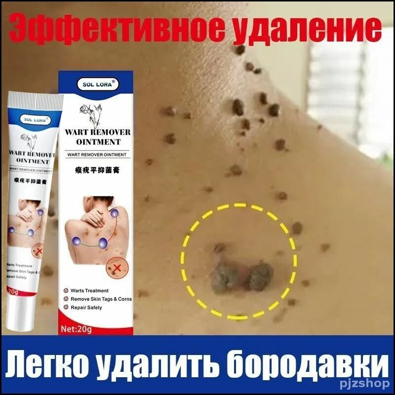 Мазь от бородавок, против генитальных бородавок, папиллом, ороговевшей кожи, мазь от прыщей, 20 гПечатная версия-Новинка