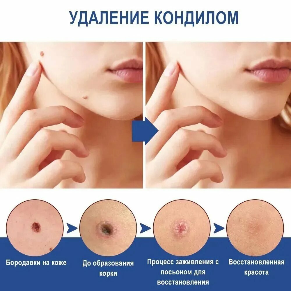 Крем для ухода за кожей — фото 1