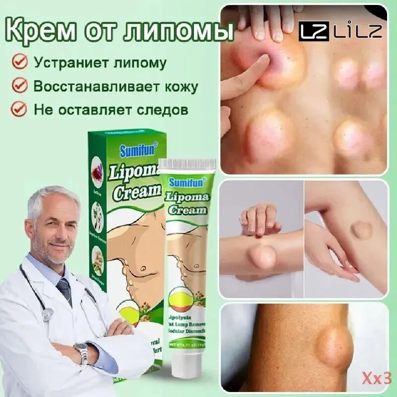 Мазь от липом и жировиков, акне, фурункулеза, быстро удаляет подкожные жировые опухоли 20 г