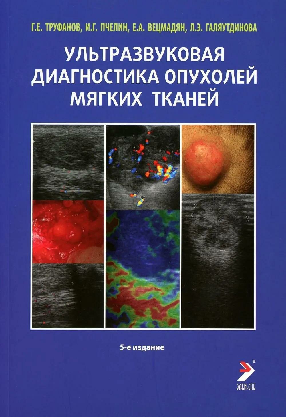 Ультразвуковая диагностика опухолей мягких тканей. 6-е издание