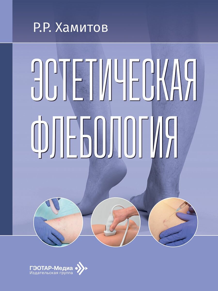 Эстетическая флебология