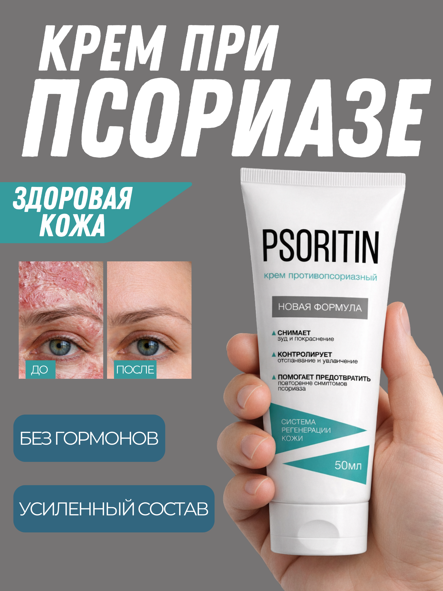 PSORITIN: крем-средство от псориаза, дерматита и экземы, натуральный состав, 50 мл