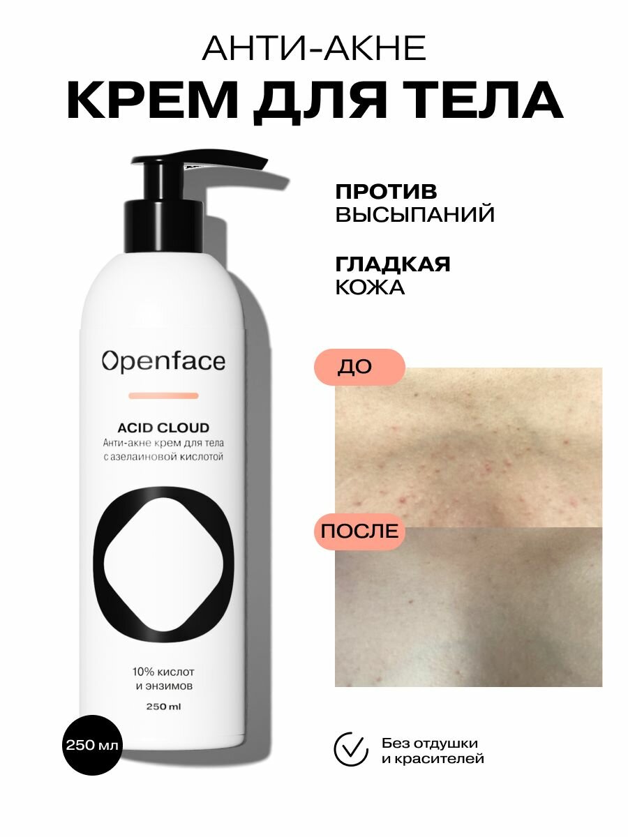 Анти-акне крем для тела с азелаиновой кислотой Openface Acid Cloud