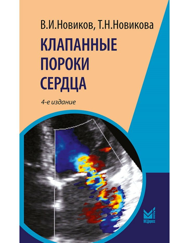 Клапанные пороки сердца