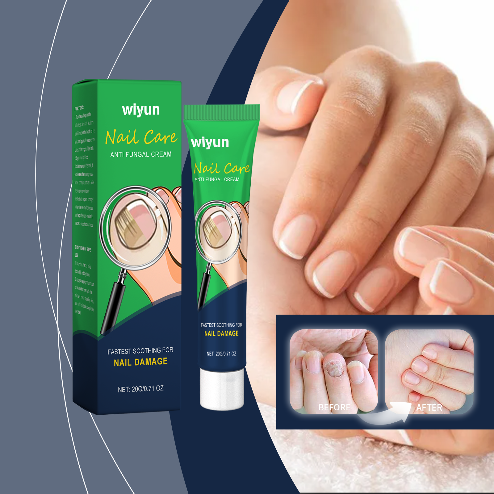 Восстанавливающий крем Wiyun Nail Care питает ногти, снимает дискомфорт, увлажняет, ухаживает за кожей, очищает и лечит