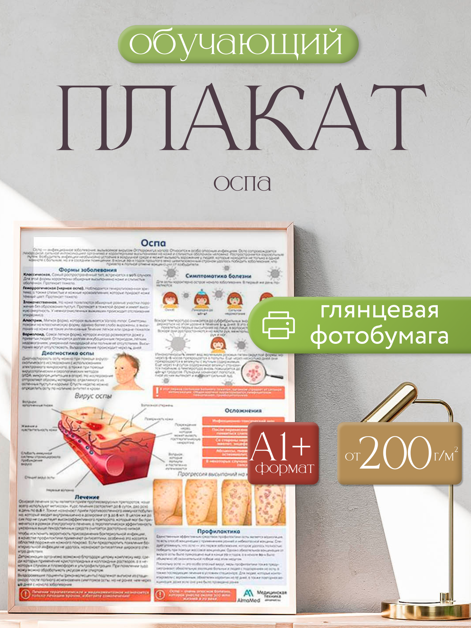 Оспа медицинский плакат, глянцевая фотобумага от 200 г/кв. м, размер A1+