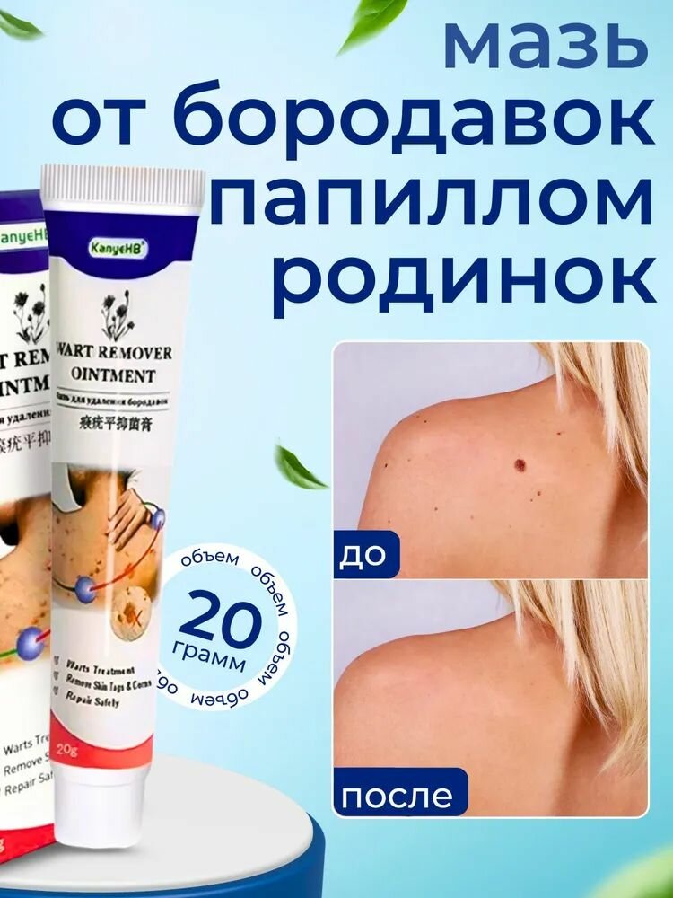 Лечебное средство /клареол гель средство от бородавок и папиллом, Для лечения бородавок, папиллом, мозолей на теле и лице Чистотел 20г.