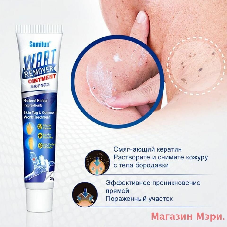 Крем для удаления бородавок и родинок от папиллом и бородавок. Натуральные растительные ингредиенты, безопасные и эффективные.
