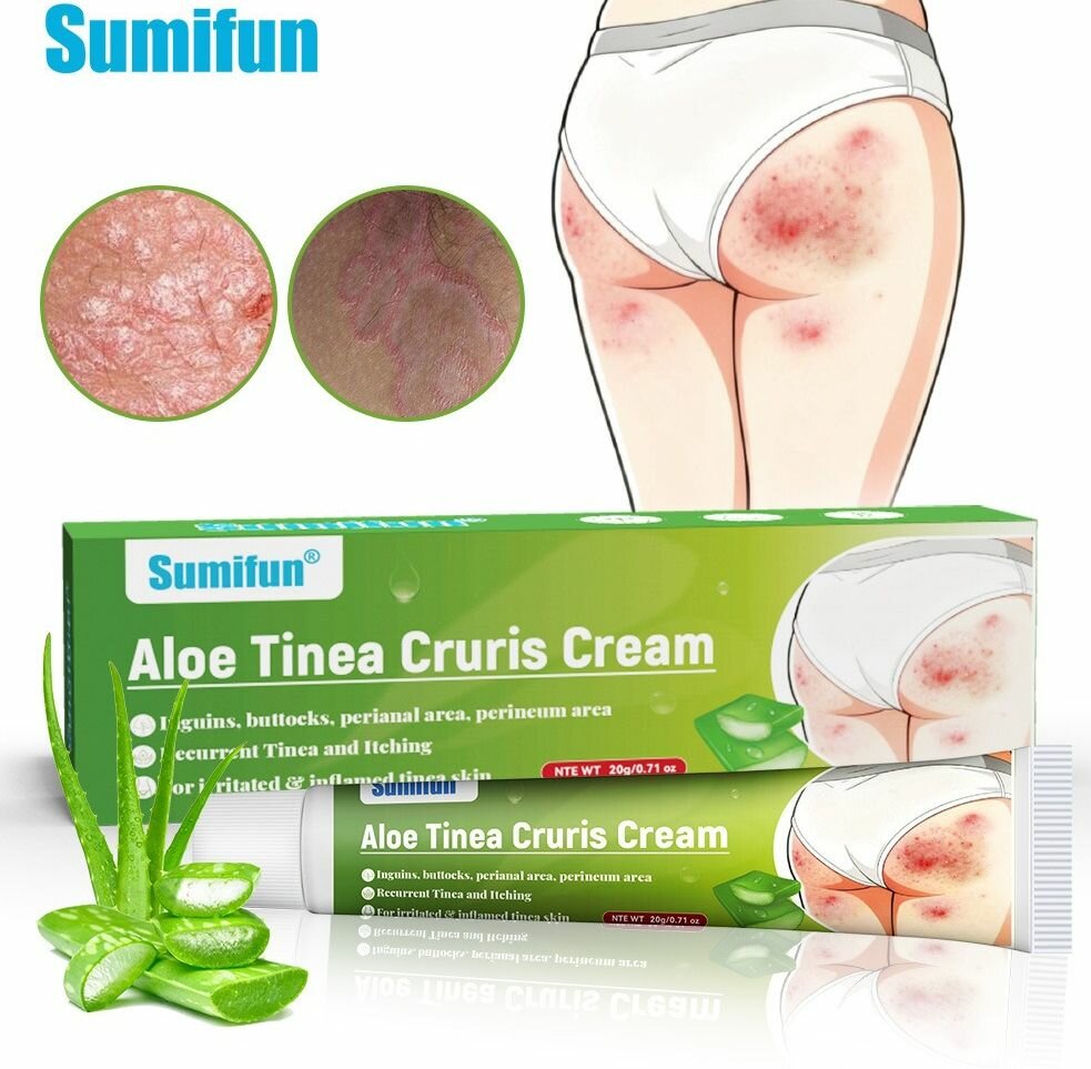 Крем от пахового дерматомикоза с алоэ вера это натуральный противогрибковый крем, который успокаивает и восстанавливает чувствительные участки тела. 1-13-zmy-29