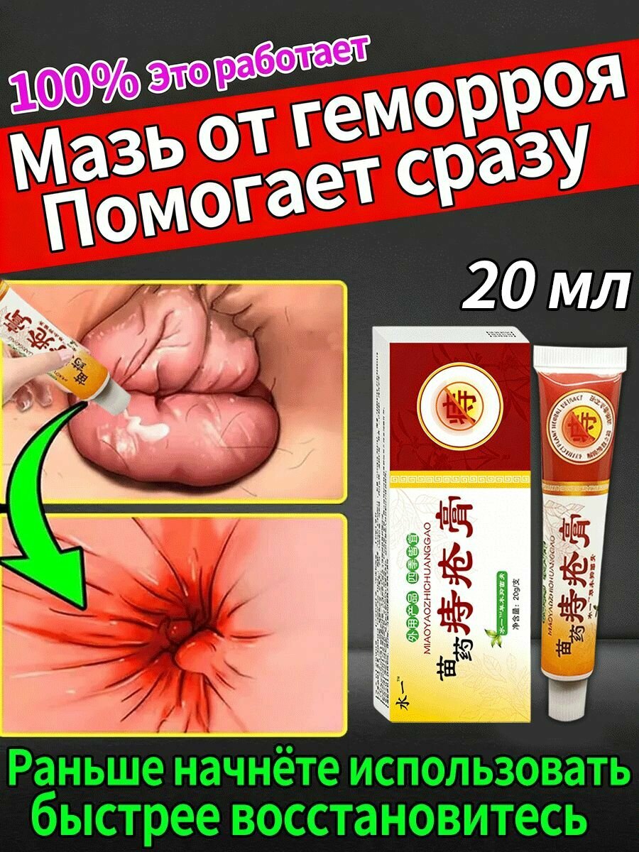 Китайская мазь от геморроя, крем от анальных трещин