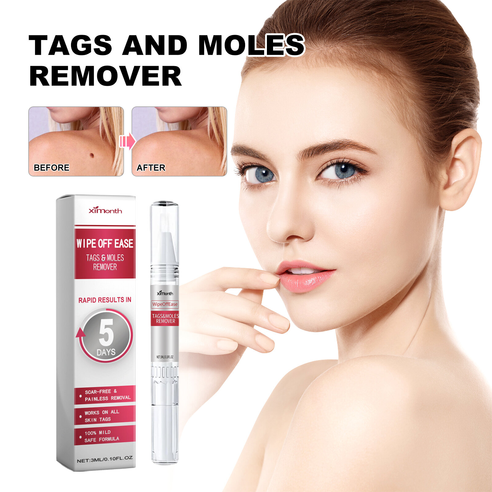 Средство для удаления бородавок на коже, очищает кожу, удаляет плоскую кожу, особенно мозоли, шипы, натоптыши, кожные метки, средство для удаления бородавок