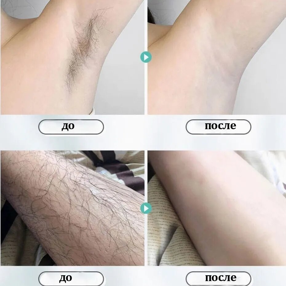 Крем для депиляции, для депиляции волос в зоне бикини, для ног, рук, лица, для всех типов кожи, для безболезненного удаления волос, 100 гм