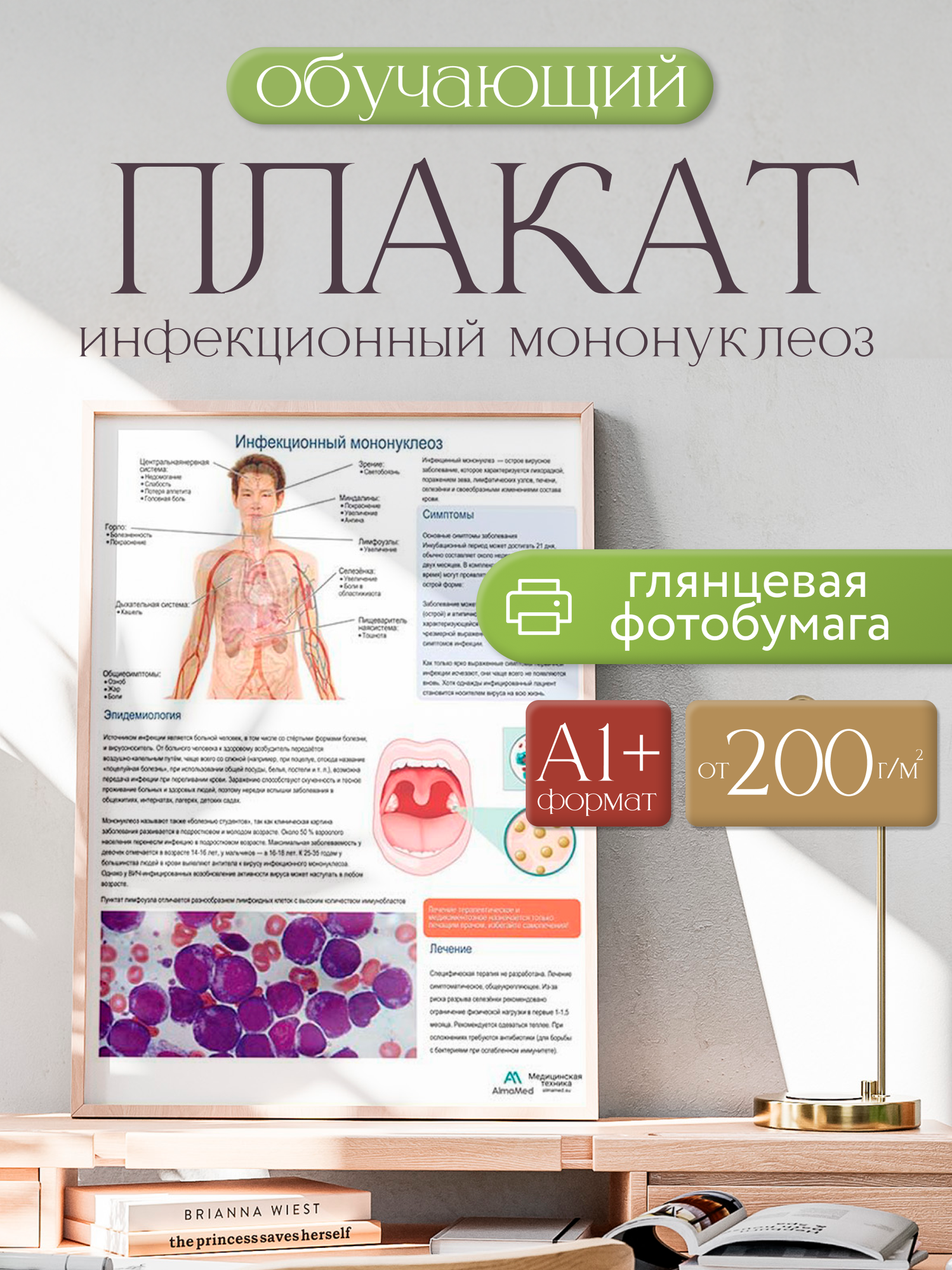 Инфекционный мононуклеоз медицинский плакат глянцевая фотобумага от 200 г/кв. м, размер A1+