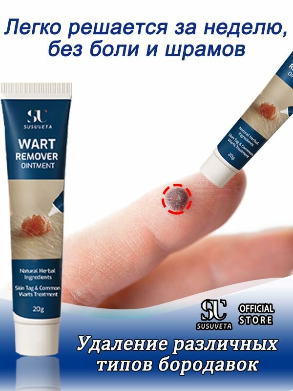 Крем средство для удаления бородавок, папиллом и родинок, безболезненно, не оставляет следов / 20г