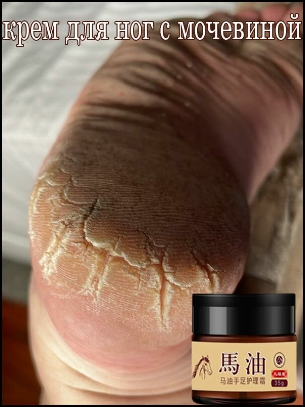 Скорая помощь пяткам! Крем с мочевиной 40% и конским жиром 35г Глубокие трещины исчезают за 5 дней, экстренное смягчение огрубевшей кожи, защита от рецидива