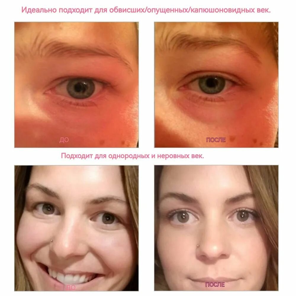 Лифтинг полоски для век, наклейки невидимые для мгновенной коррекции верхнего нависшего века, как средство для ухода за кожей глаз, макияжа и подтяжки лица от морщин, набор 200 пар