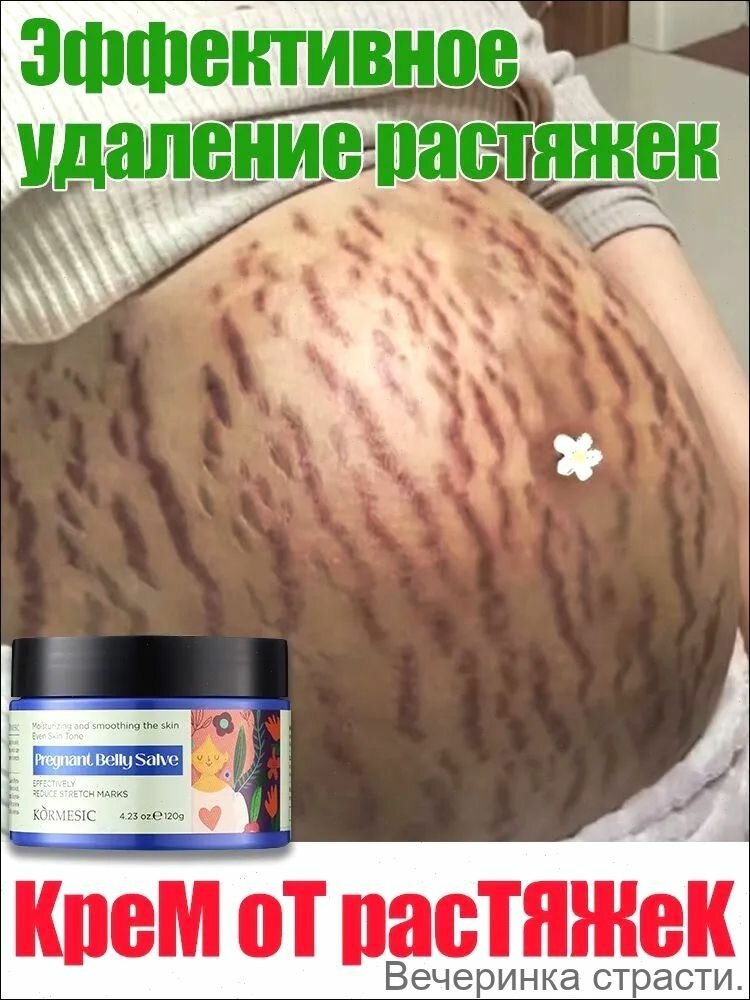 Крем от растяжек для беременных 120 г удаляет растяжки, восстанавливает упругость кожи, для тела, груди, ягодиц, живота росле родов