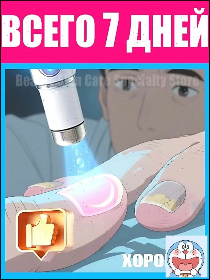 Лазерная ручка для лечения онихомикоза может устранить стойкий онихомикоз за 7 дней, улучшить состояние при паронихии, а также вылечить утолщение ногтей, покраснение, отек, зуд, расслоение и т. д.