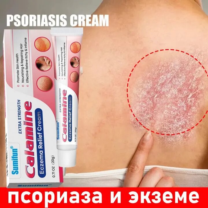 Крем Sumifun для ухода за кожей от экземы/псориаза/атопического дерматита/зуда для взрослых и детей 20 мл