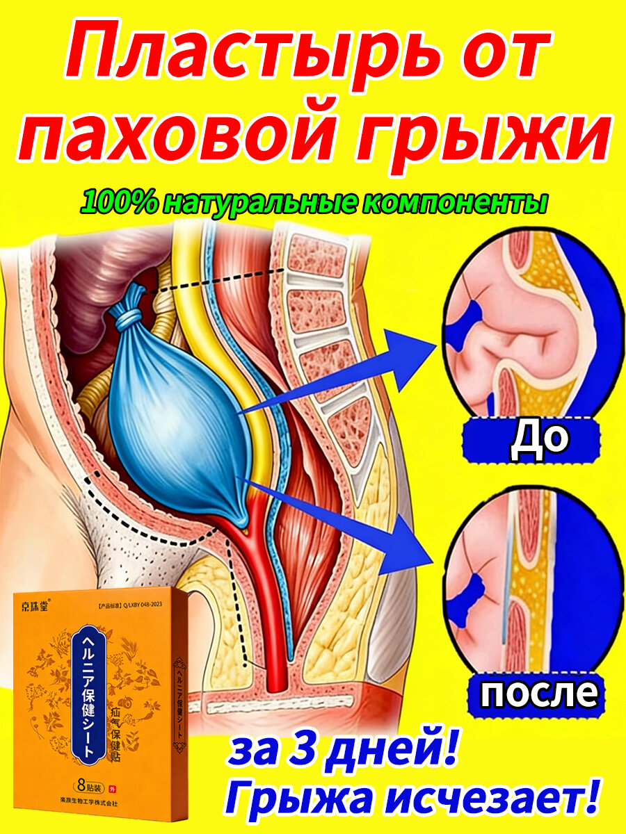 Китайский пластырь от пупочной грыжи детский паховый грыжевой мужской, Растительный экстракт