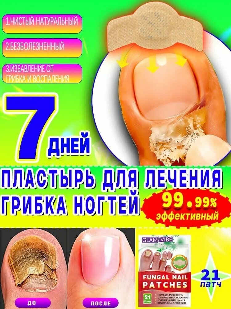 Пластыри от грибка ногтей: снимают зуд, лечат грибковые инфекции, ухаживают за ногтями и окружающей кутикулой, а также восстанавливают паронихий. В упаковке 210 пластырь.