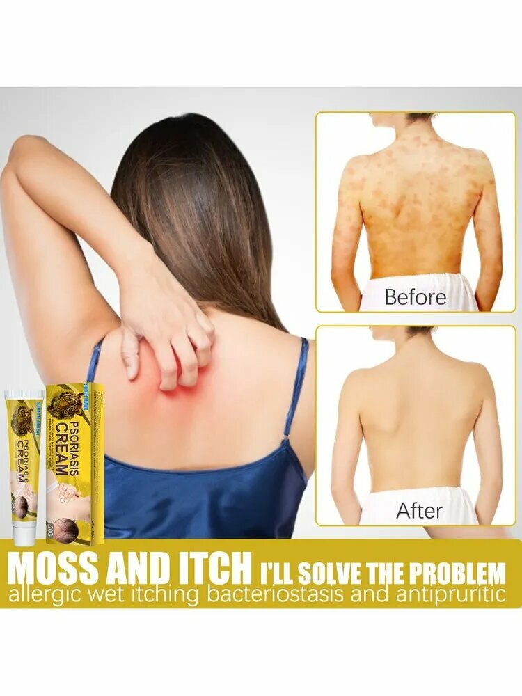 Мазь для ухода за кожей South Moon, увлажняющая и восстанавливающая, наружного применения, крем кожи