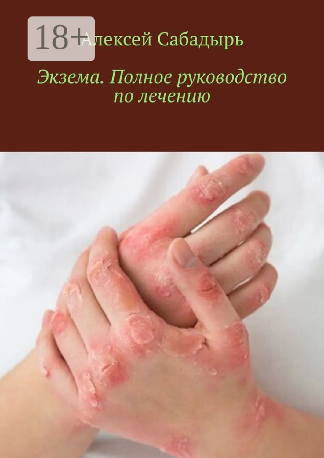 Экзема. Полное руководство по лечению [Цифровая книга]