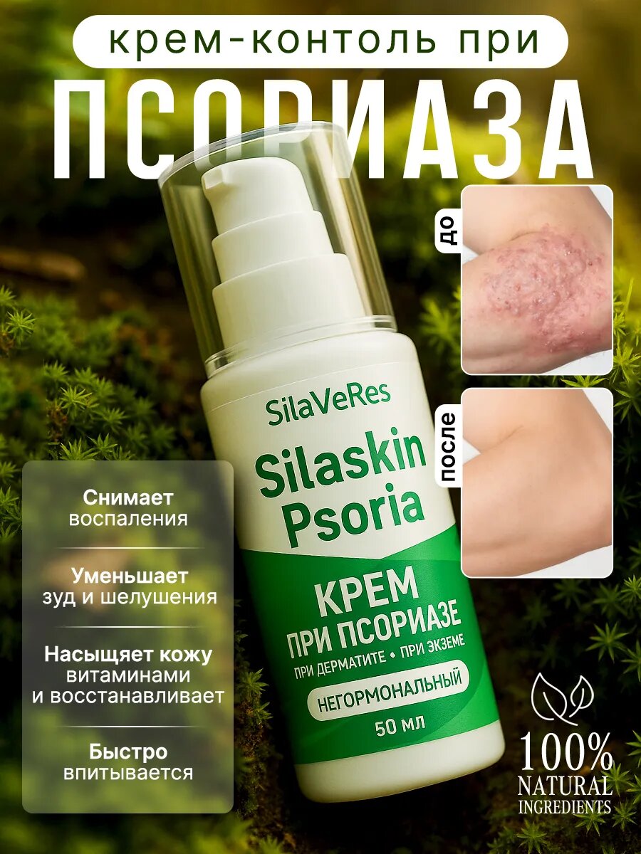 Крем от псориаза и дерматита