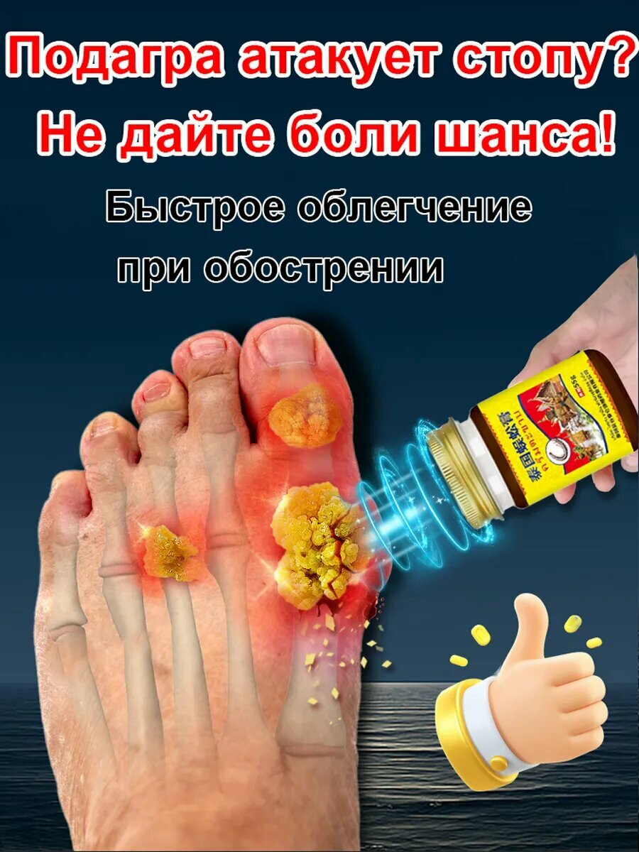 Мазь от подагры на ноге и для рук и артрита，55 г