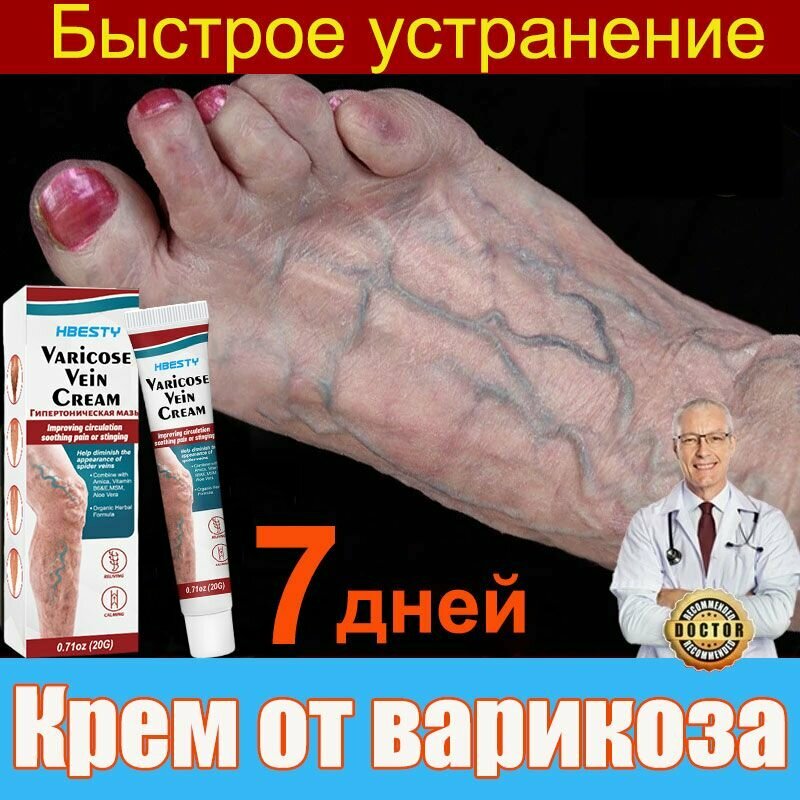Крем мазь от варикоза, Эффективен при лечении варикозного расширения вен, сосудистых звездочек, тромбоза, усталости, опухших ног и боли, с охлаждающим эффектом, 20г