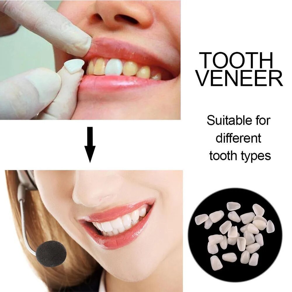 50 шт. ультратонкие виниры для зубов, отбеливающая смола, передние верхние коронки