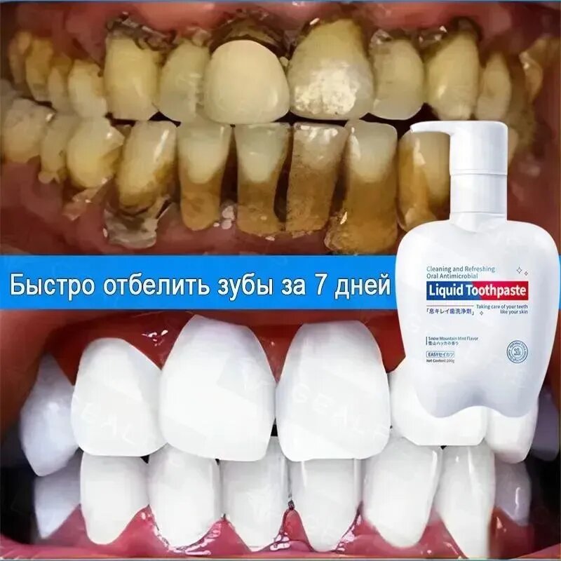 Паста отбеливающая зубная желтые зубы для налетОт запаха изо рта, от кариеса 200 г
