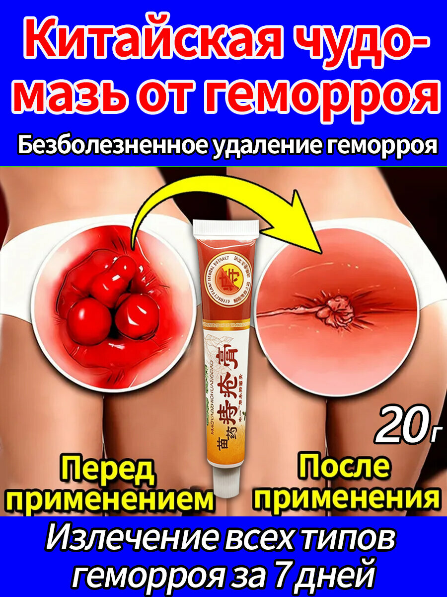 Мазь от геморроя китайское средство гербальный крем быстрое облегчение снятия зуда и отека без рецепта