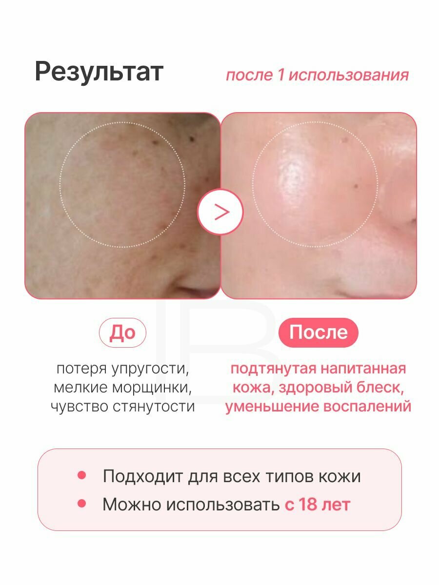 Сыворотка для лица — фото 1