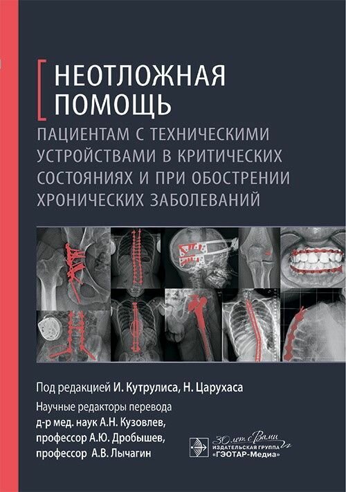 Неотложная помощь пациентам с техн. устройствами в критических состояниях и при обострении хрон. забол