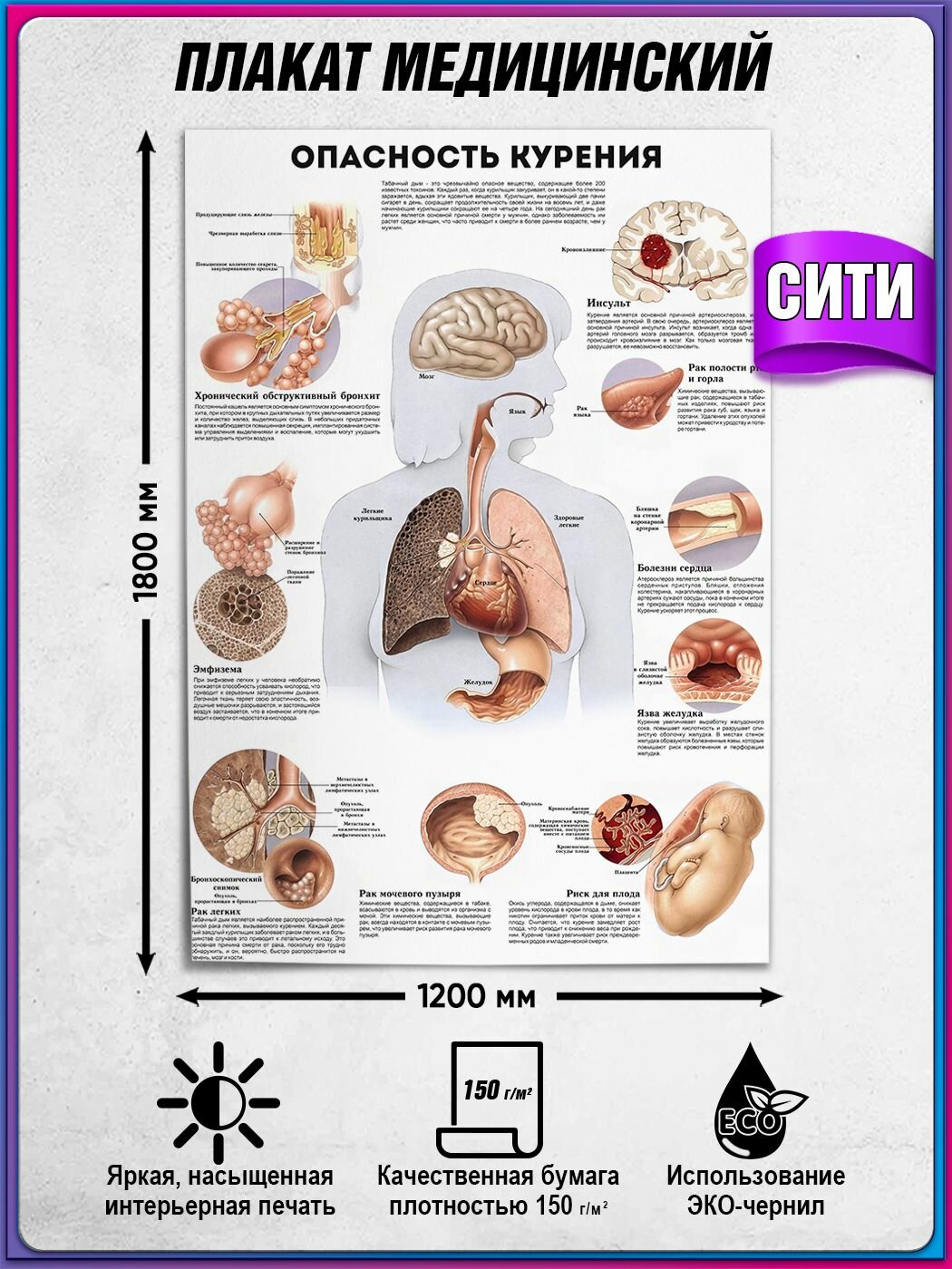 Информационный медицинский плакат "Опасность курения" / Формат сити (120х180 см.)