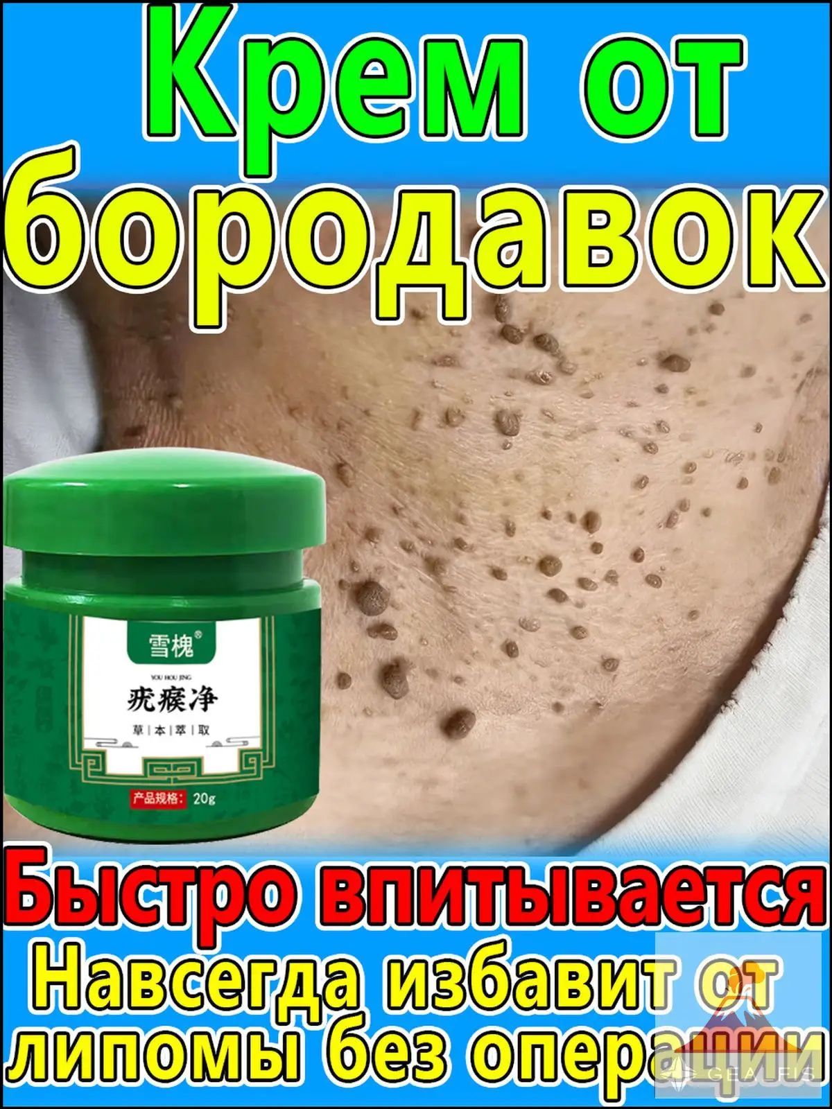Средство для удаления кератом