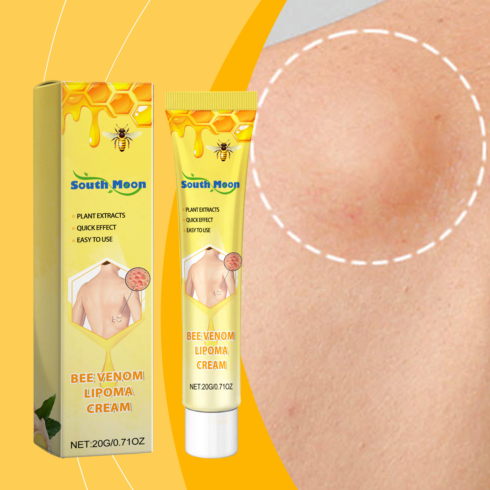 Крем для жирных узлов с пчелиным ядом увлажняет кожу и снимает комочки успокаивающий крем для ухода за телом